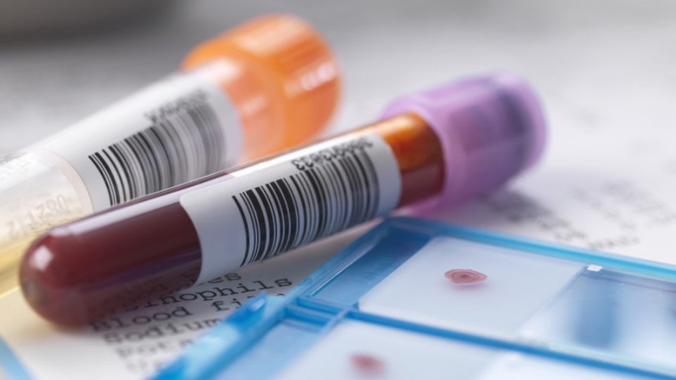 ét nghiệm Triple test là gì? Những điều mẹ cần biết về Triple test